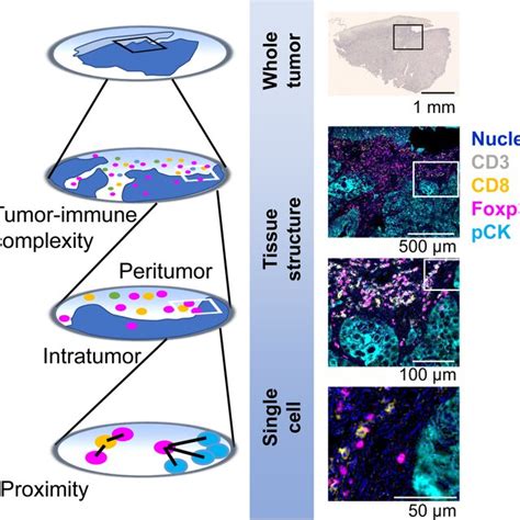 Multi‐layered Spatial Information Defines The Landscape Of The Tumor
