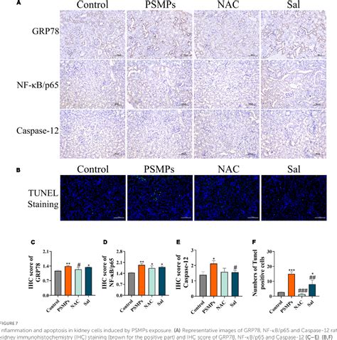 Figure 7 From Polystyrene Microplastics Induced Nephrotoxicity