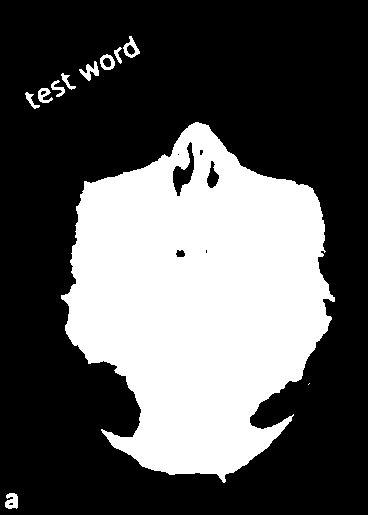 python how to detect text on an x ray image with opencv stack overflow