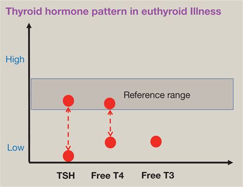 Understanding And Interpreting Thyroid Function Tests Paediatrics And