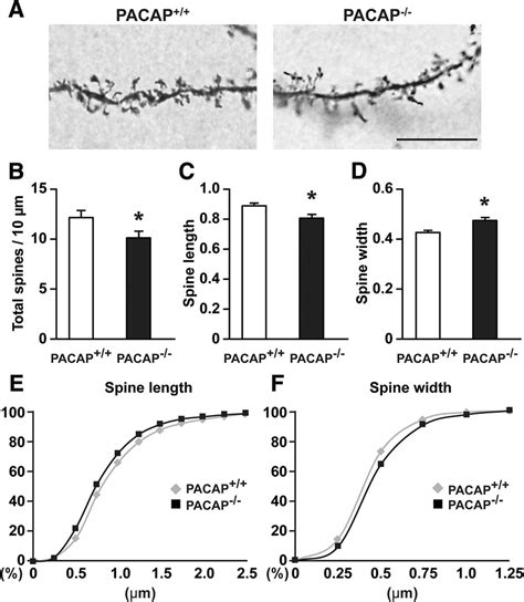 Morphological Analysis Of Dendritic Spines On Hippocampal Pyramidal