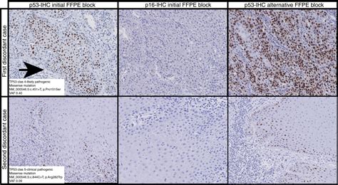 Performance Of The Pattern‐based Interpretation Of P53