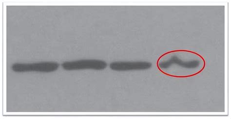 wb实验条带问题？原因分析和解决方法都在这里 自主发布 资讯 生物在线