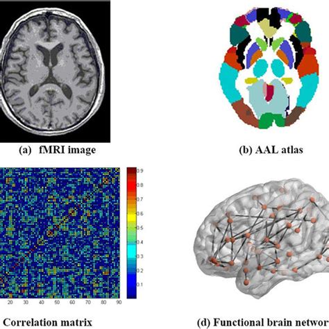 The Process Of Constructing A Functional Brain Network A The Brain