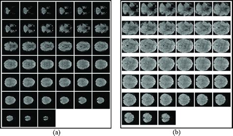An Example Of Preprocessing Using Spm8 Software A Original Fmri