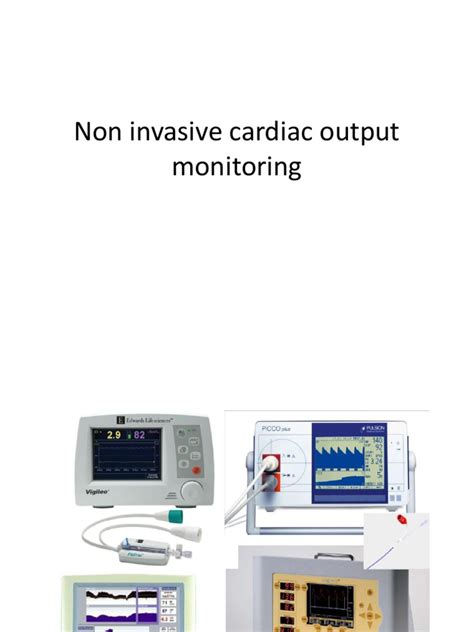 Non Invasive Cardiac Output Monitoring Pdf Angiology Medical