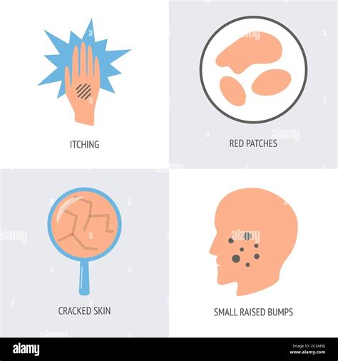 Eczema Symptoms Icon Set In Flat Style Skin Allergy Symbols Isolated
