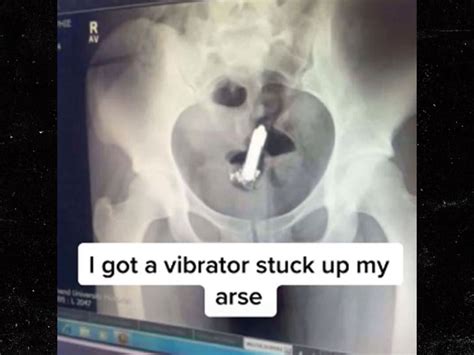 Who Is Tiktoker Sophzaloafs Tiktok Star Needed Surgery After Sex Toy