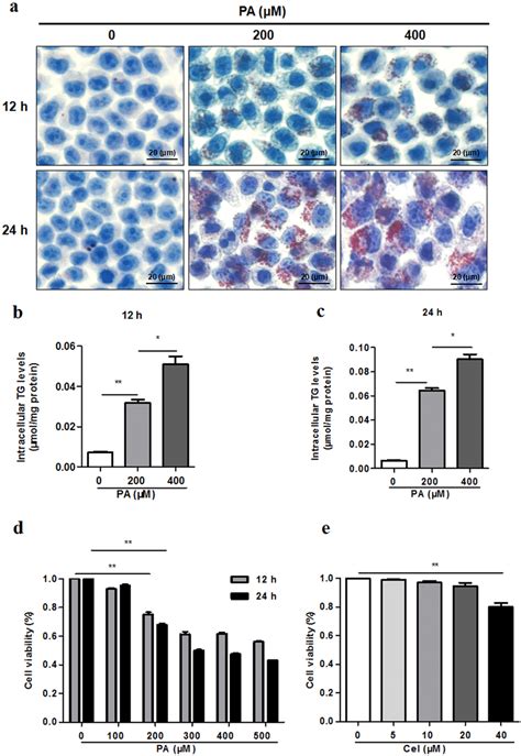 Pa Induces Lipid Accumulation In Hepatocytes A C L02 Hepatic Cells