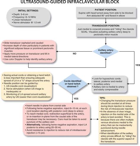 Ultrasound Guided Infraclavicular Brachial Plexus Block Anesthesia Key