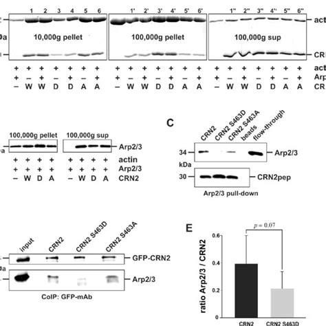 Phosphorylation Of S463 Controls F Actin Bundling Activity And Arp2 3