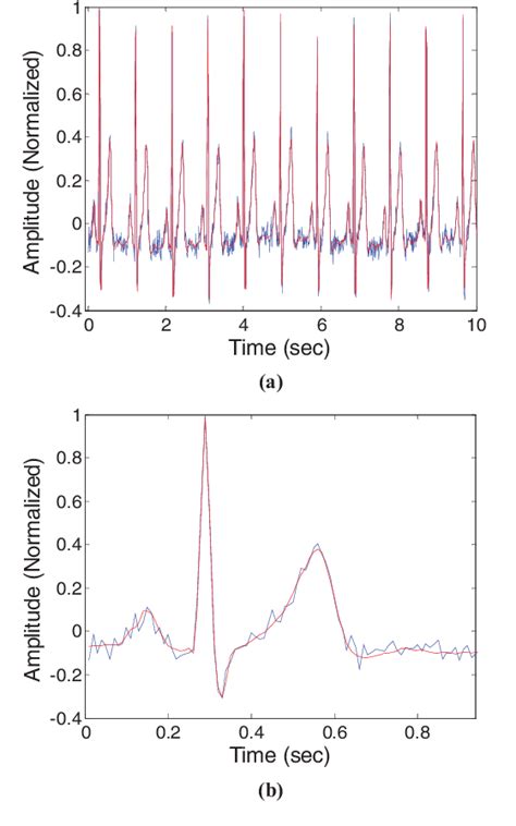 Figure 1 From A Comparison Of Time Delay Estimation Methods And
