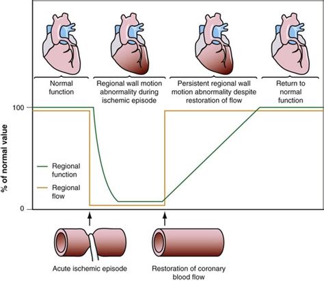 Nuclear Medicine Imaging Of Myocardial Viability Radiology Key