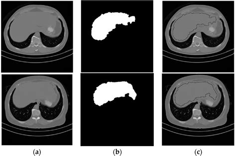 Applied Sciences Free Full Text Abdomen Fat And Liver Segmentation