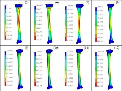 Figure 12 From Stress Distribution In Human Tibia Bones Using Finite