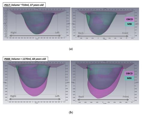 applied sciences free full text wavelia breast imaging the optical