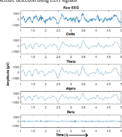 Figure 1 From Epileptic Eeg Signal Classification Using Machine