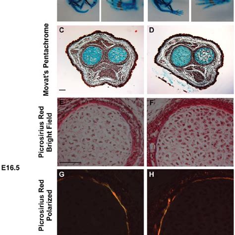 Generation And Confirmation Of Bone Specific Kif3a Conditional Knockout