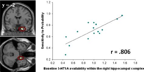 Left Statistical Parametric Map Spm Depicting 11 C Cumi Bind