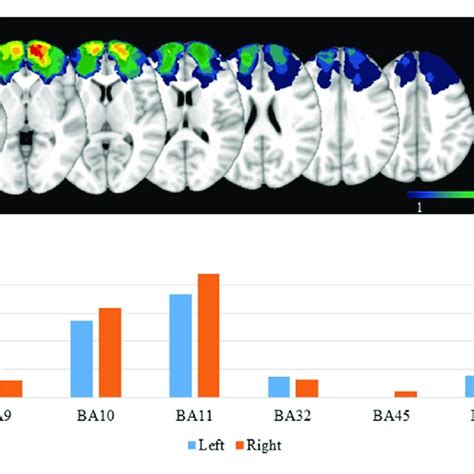 Lesion Reconstructions For The Orbitofrontal Cortex Ofc Group A