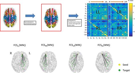 A Flow Chart Of Functional Connectivity Strength Fcs First The