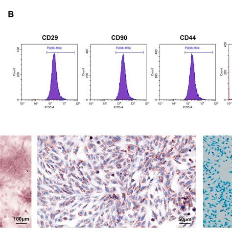 Extraction And Characterization Of Bmsc Derived Exosomes A