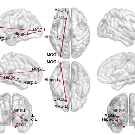 Graph Visualization Of Functional Connectivity Comparison Differences