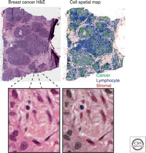 Spatial Heterogeneity In The Tumor Microenvironment