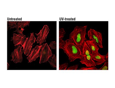 Overview Of Cellular Senescence And Aging Cell Signaling Technology