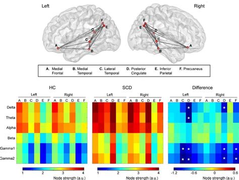 Upper Panel The Intrinsic Functional Connectivity Of Default Mode