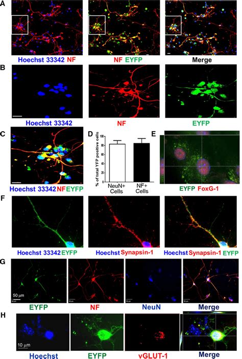 Neuronal Differentiation Of Lmo3 Ips Cells Lmo3 Ips Npcs Were