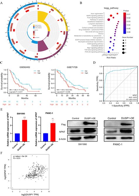 Dusp1 Promotes Pancreatic Cancer Cell Proliferation And Invasion By