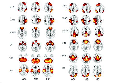 Twelve Rsns In Three Groups Download Scientific Diagram