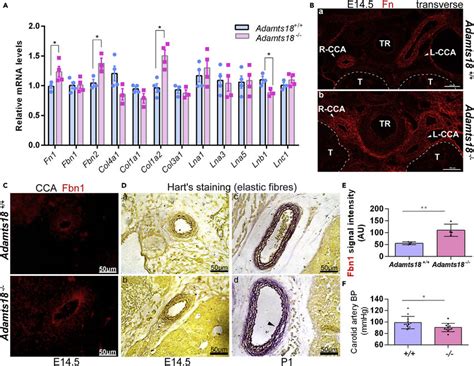 Expression Of Ecm Molecules In Cervicothoracic Vascular Tissue Of