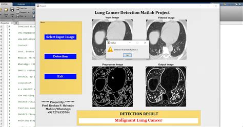 Lung Cancer Detection Using Image Processing Matlab Project With Source