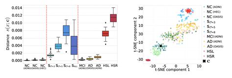 Learning Normal Asymmetry Representations For Homologous Brain
