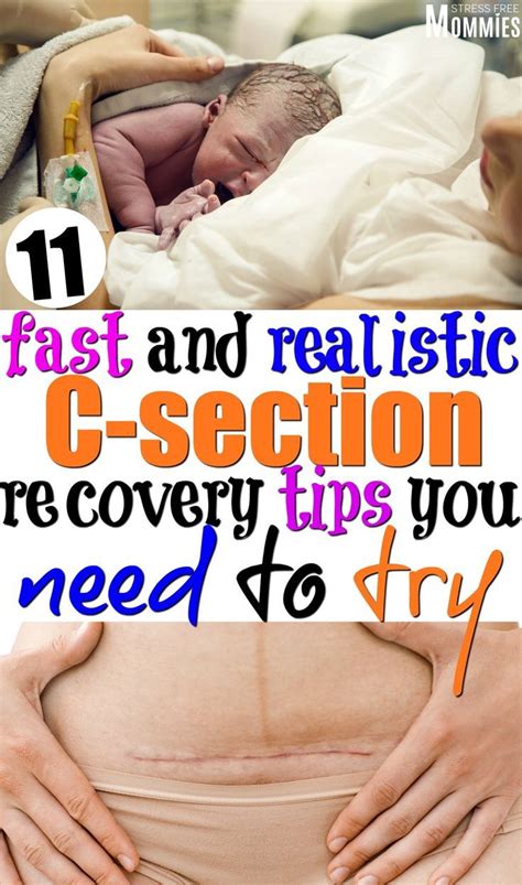 Fast And Realistic C Section Recovery Tips You Need To Try C Section