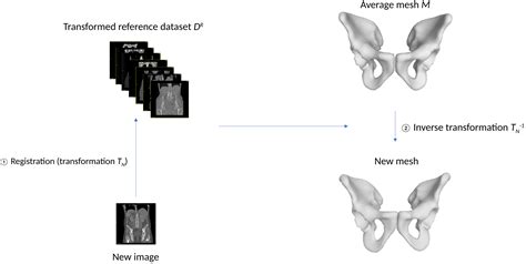 Sex Estimation From Coxal Bones Using Deep Learning In A Population