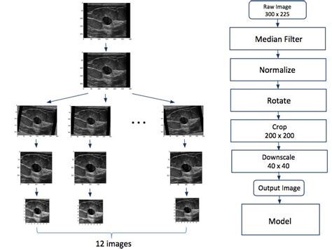 automating breast cancer detection with deep learning