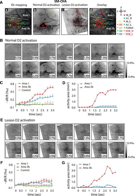 Altered Spatiotemporal Dynamics Of Cortical Activation To Tactile