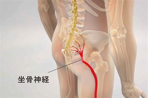 【腰から片側の足にかけての痛み】坐骨神経痛の原因と3つの対処法を専門家が解説！ 株式会社リハサク