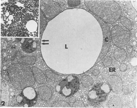 Zona Reticularis Cell From An Sh Rat 70 Weeks Of Age Prominent
