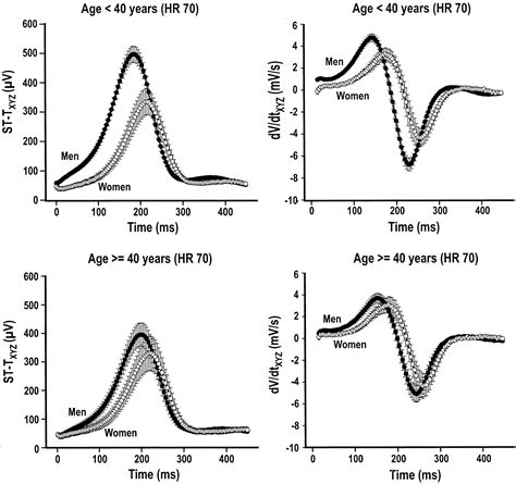 sexual dimorphism in the electrocardiographic dynamics of human