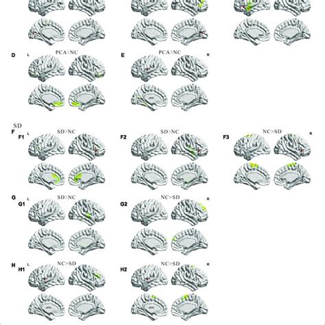 Group Differences In Regional Functional Connectivity From Seed