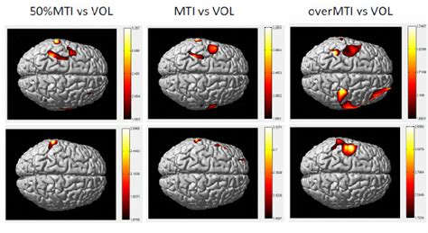 Nirs Spm Cortical Activation Maps N 9 P Download Scientific Diagram