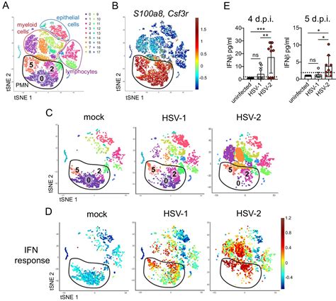 A Sustained Type I Ifn Neutrophil Il 18 Axis Drives Pathology During