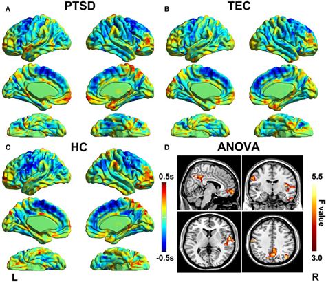 Lag Projection Maps In Ptsd Tec And Hc Group And The Anova Result