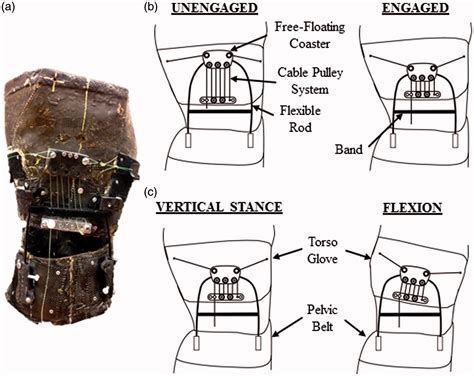 A Novel Distractive And Mobility Enabling Lumbar Spinal Orthosis
