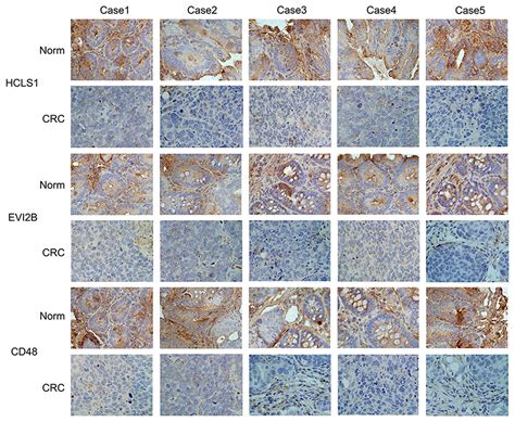 Frontiers Identification Hub Genes In Colorectal Cancer By