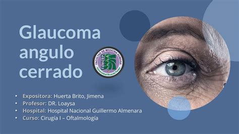Glaucoma Agudo De ángulo Cerrado